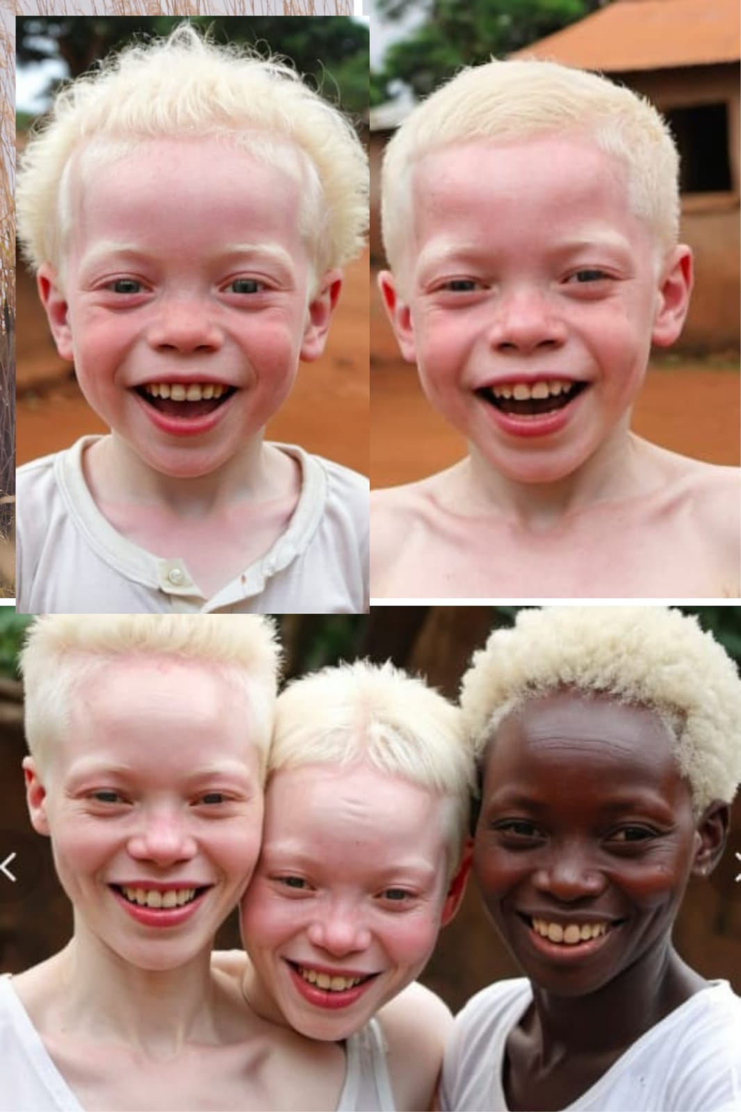 The Fact Checker: Myths and Facts surrounding persons with Albinism ...